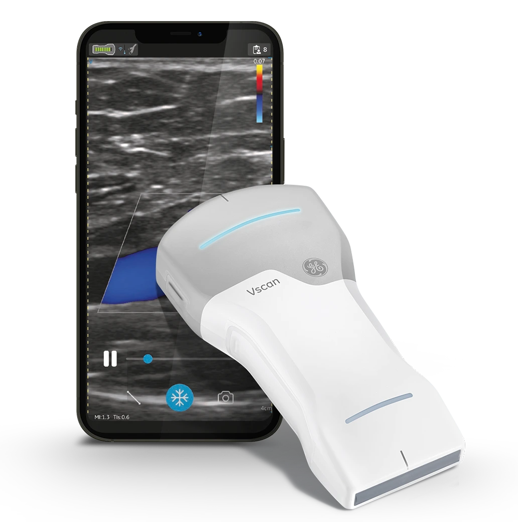 GE Vscan Air Systems